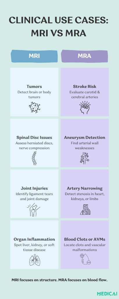 Diferencia entre MRI y MRA: 9 factores cruciales
